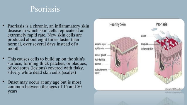 dermatology - Psoriasis | PPT