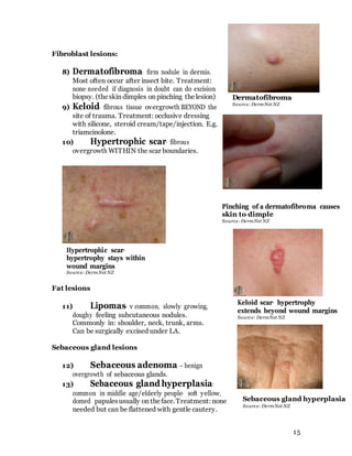 Dermatology revision book | DOCX