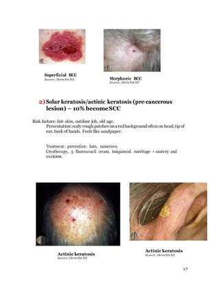 Dermatology revision book | DOCX