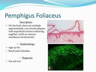 Comprehensive Dermatology: Diagnosis and Management of Skin Lesions and ...