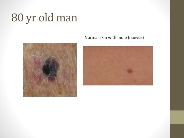 Dermatology | PPTX | Skin and Dermatology | Diseases and Conditions