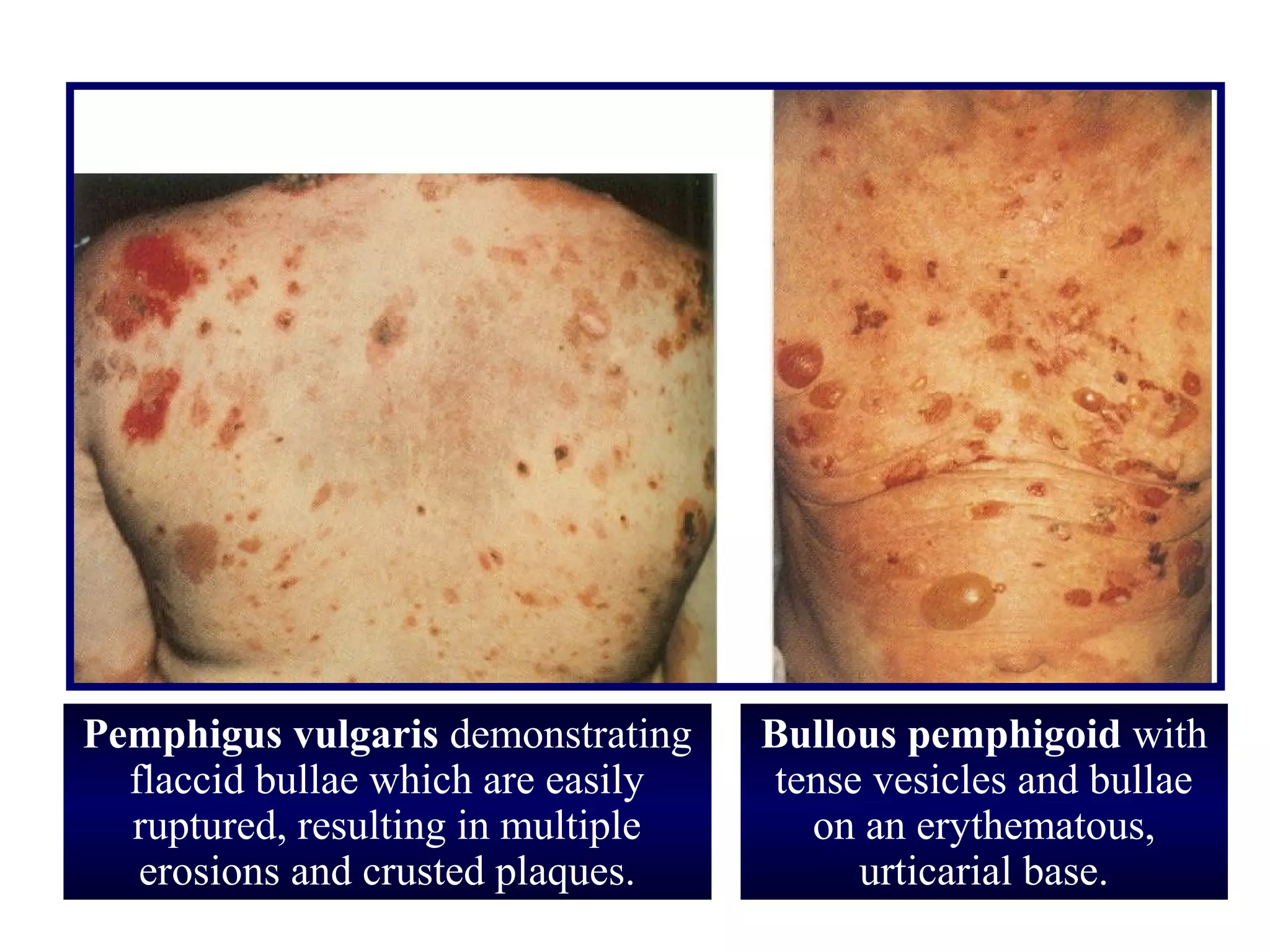 Dermatology approach | PPT