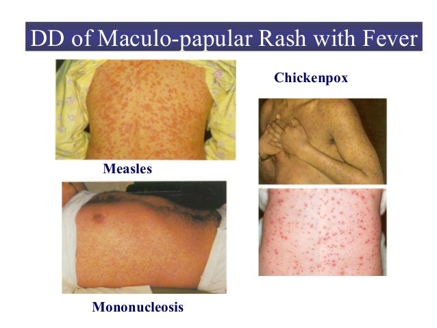 Dermatology approach