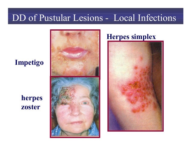 Dermatology approach