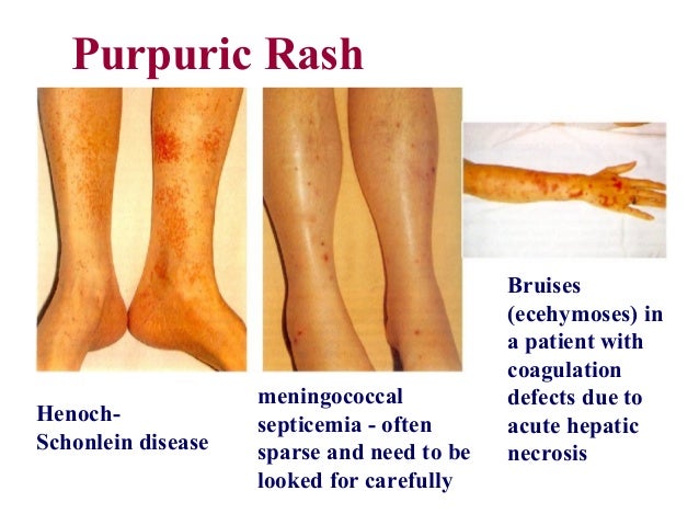 Dermatology approach