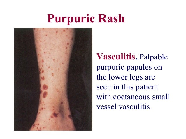 Dermatology approach