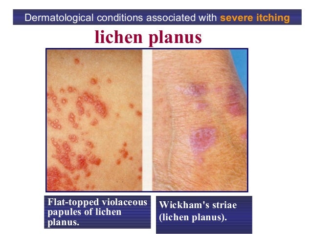 Dermatology approach