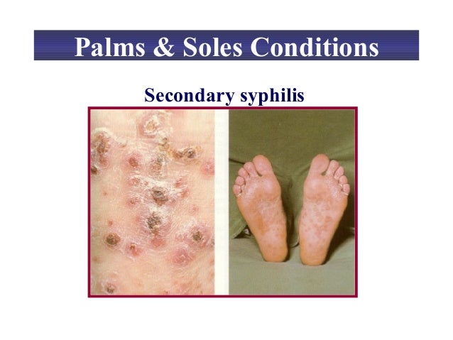 Dermatology approach