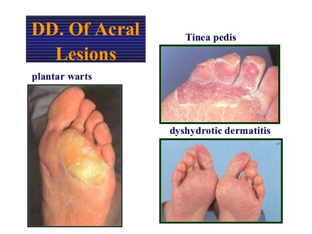 Dermatology approach