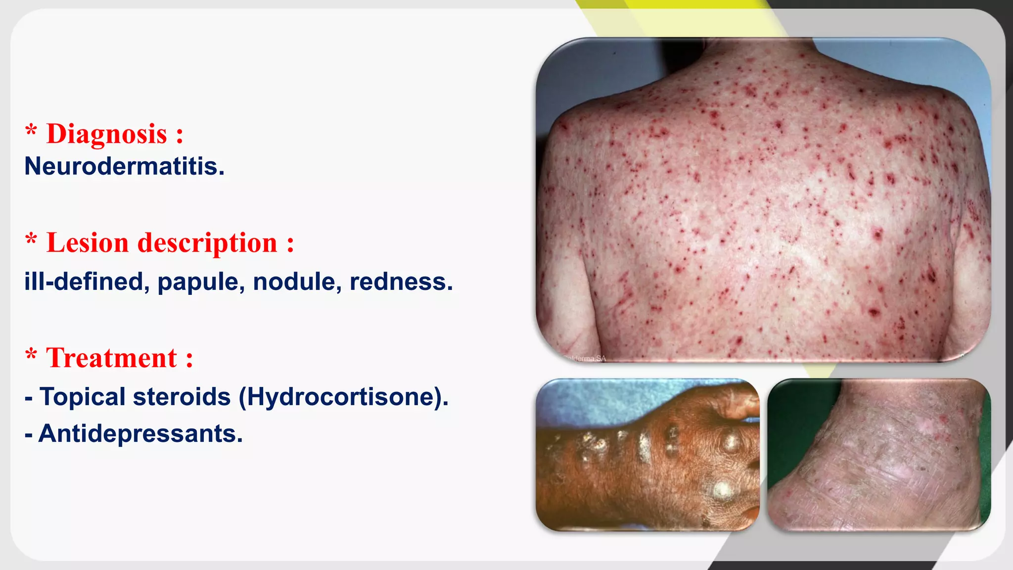 Dermatology (diagnosis of dermatological lesions) | PDF