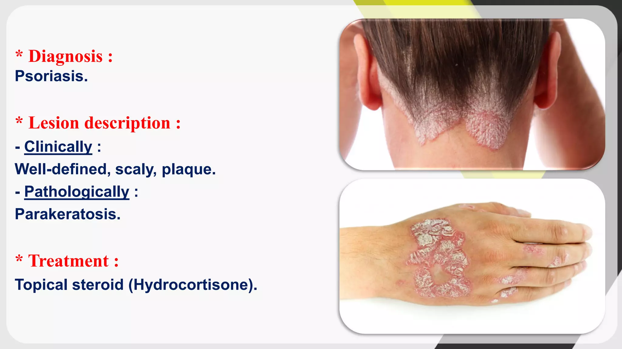 Dermatology (diagnosis of dermatological lesions) | PDF