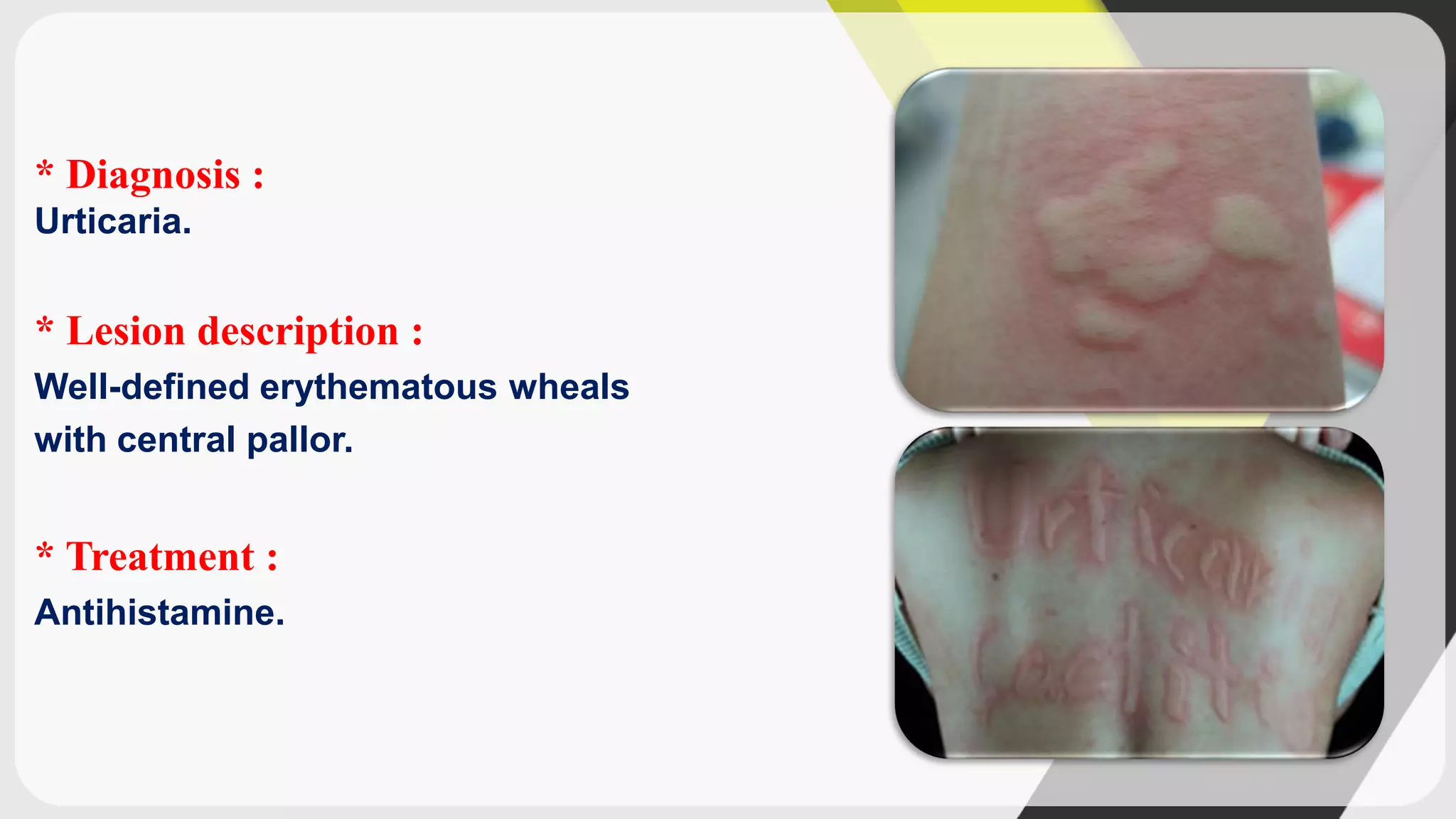 Dermatology (diagnosis of dermatological lesions) | PDF