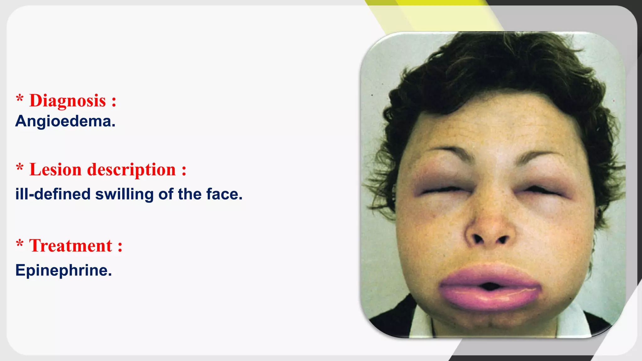 Dermatology (diagnosis of dermatological lesions) | PDF