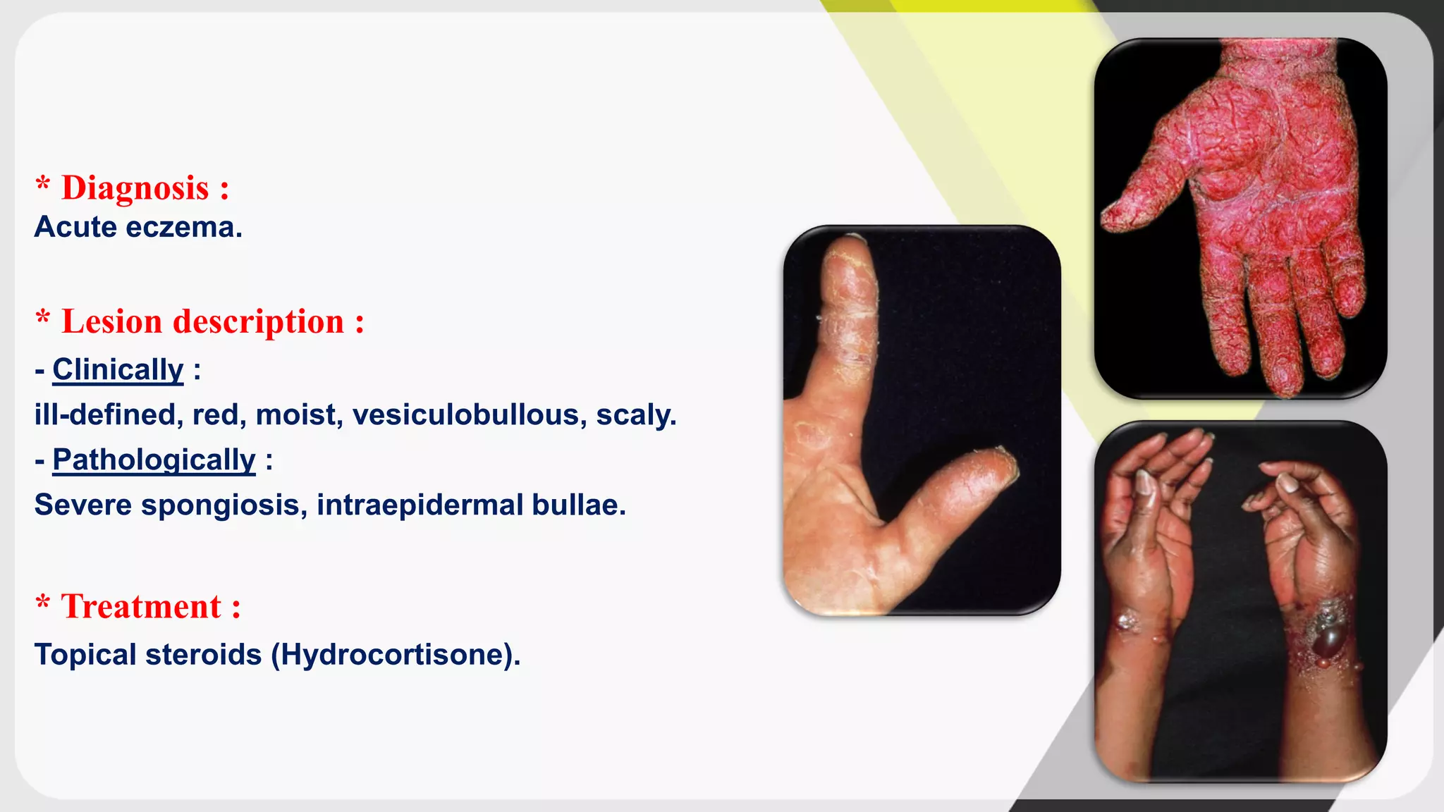 Dermatology (diagnosis of dermatological lesions) | PDF