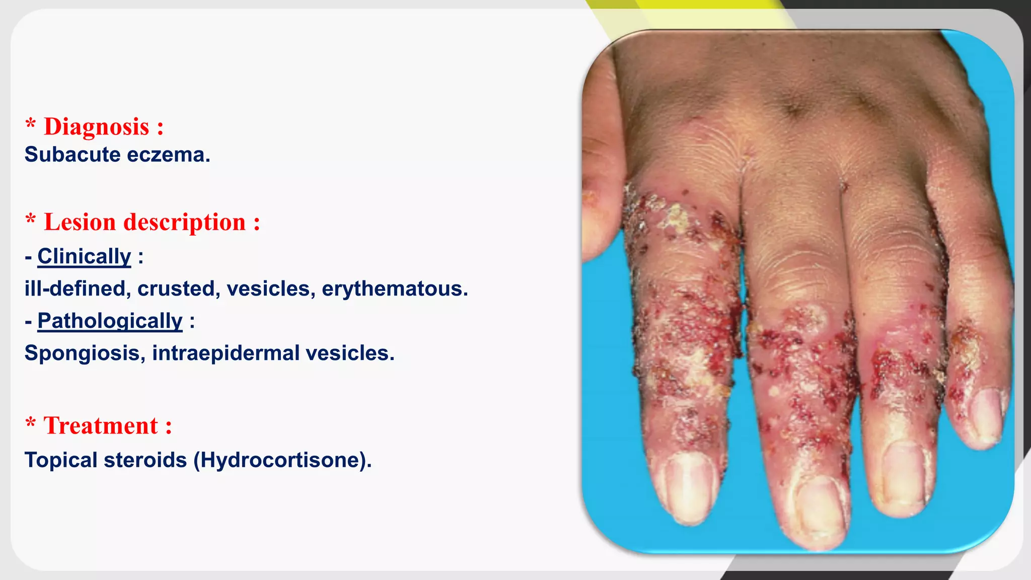 Dermatology (diagnosis of dermatological lesions) | PDF
