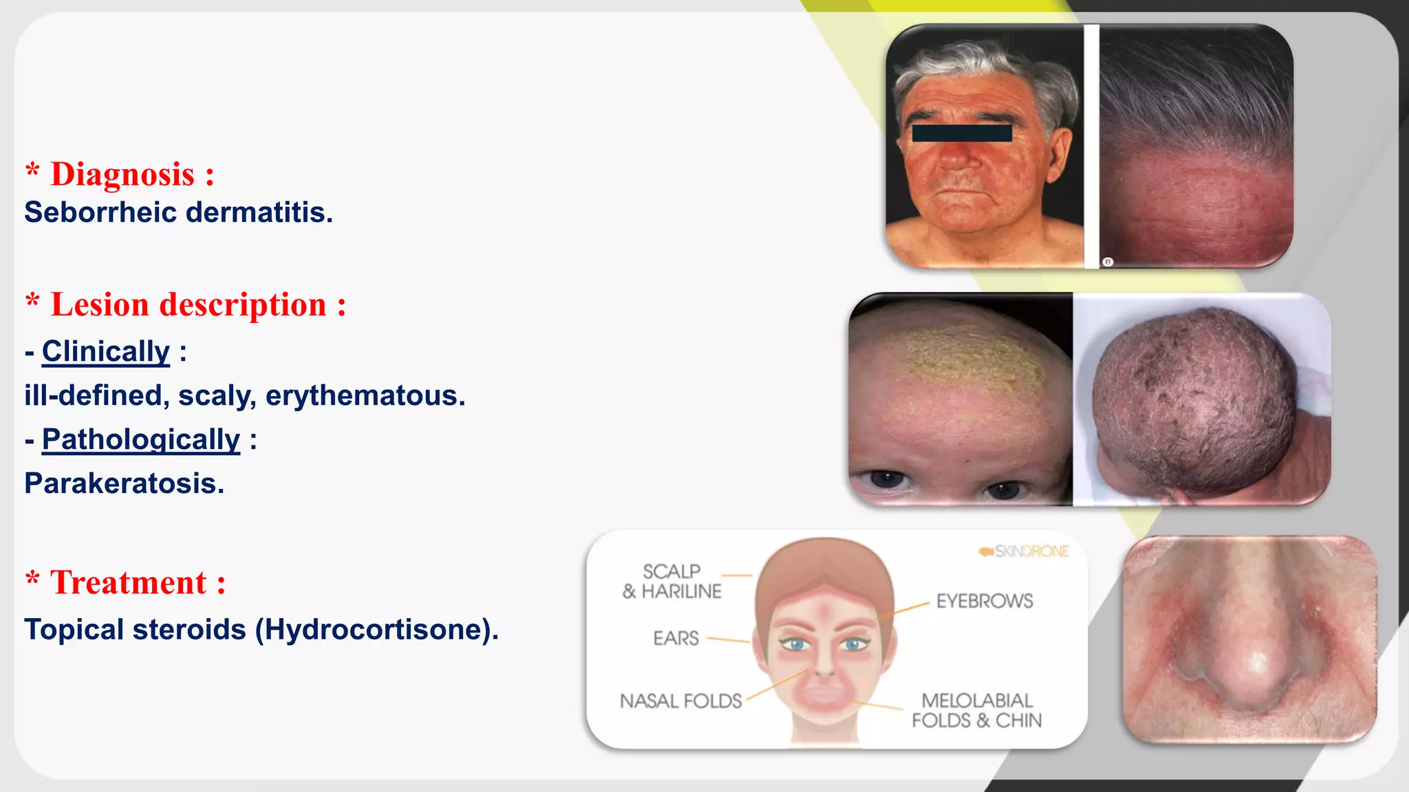 Dermatology (diagnosis of dermatological lesions) | PDF