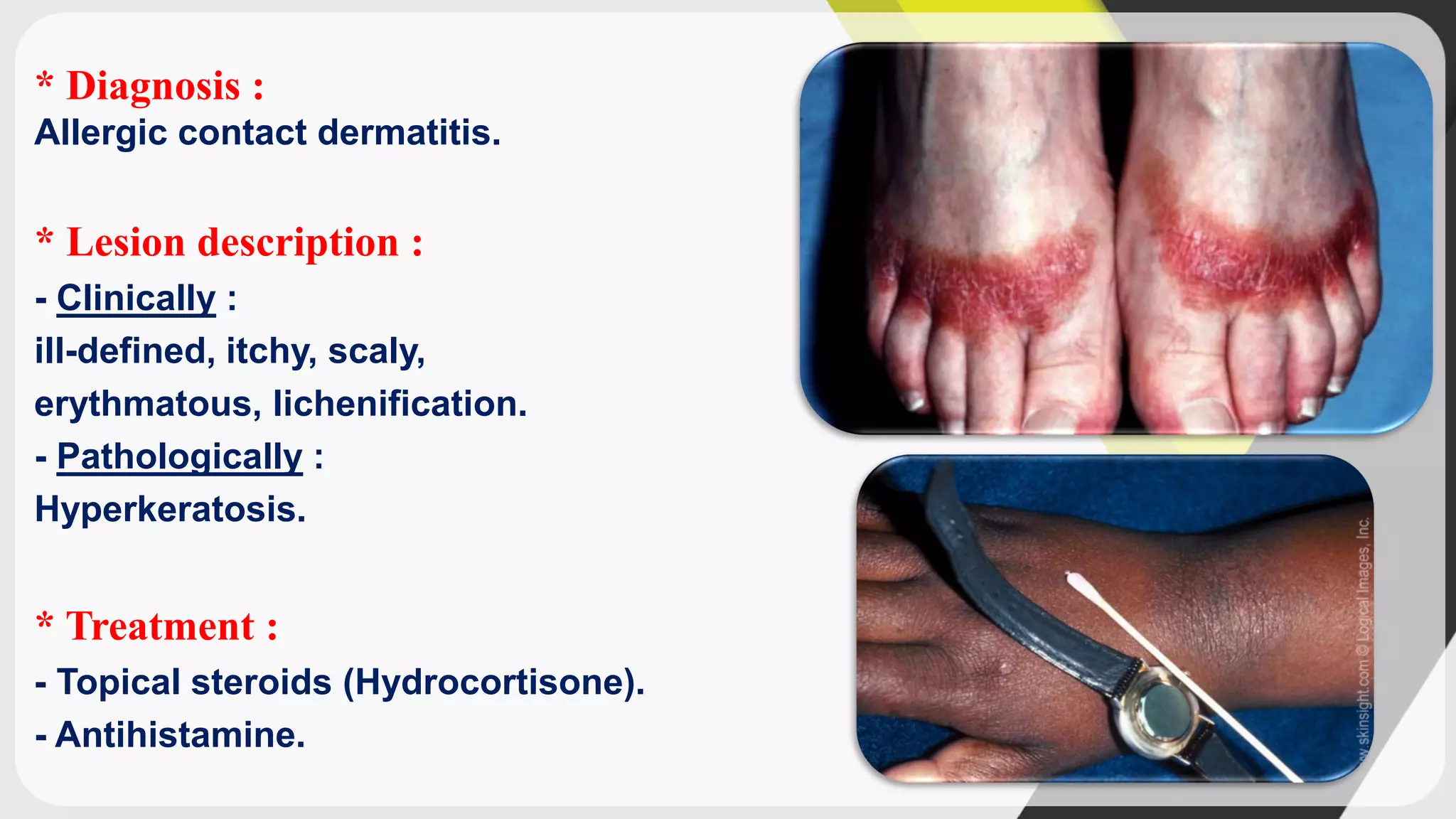 Dermatology (diagnosis of dermatological lesions) | PDF