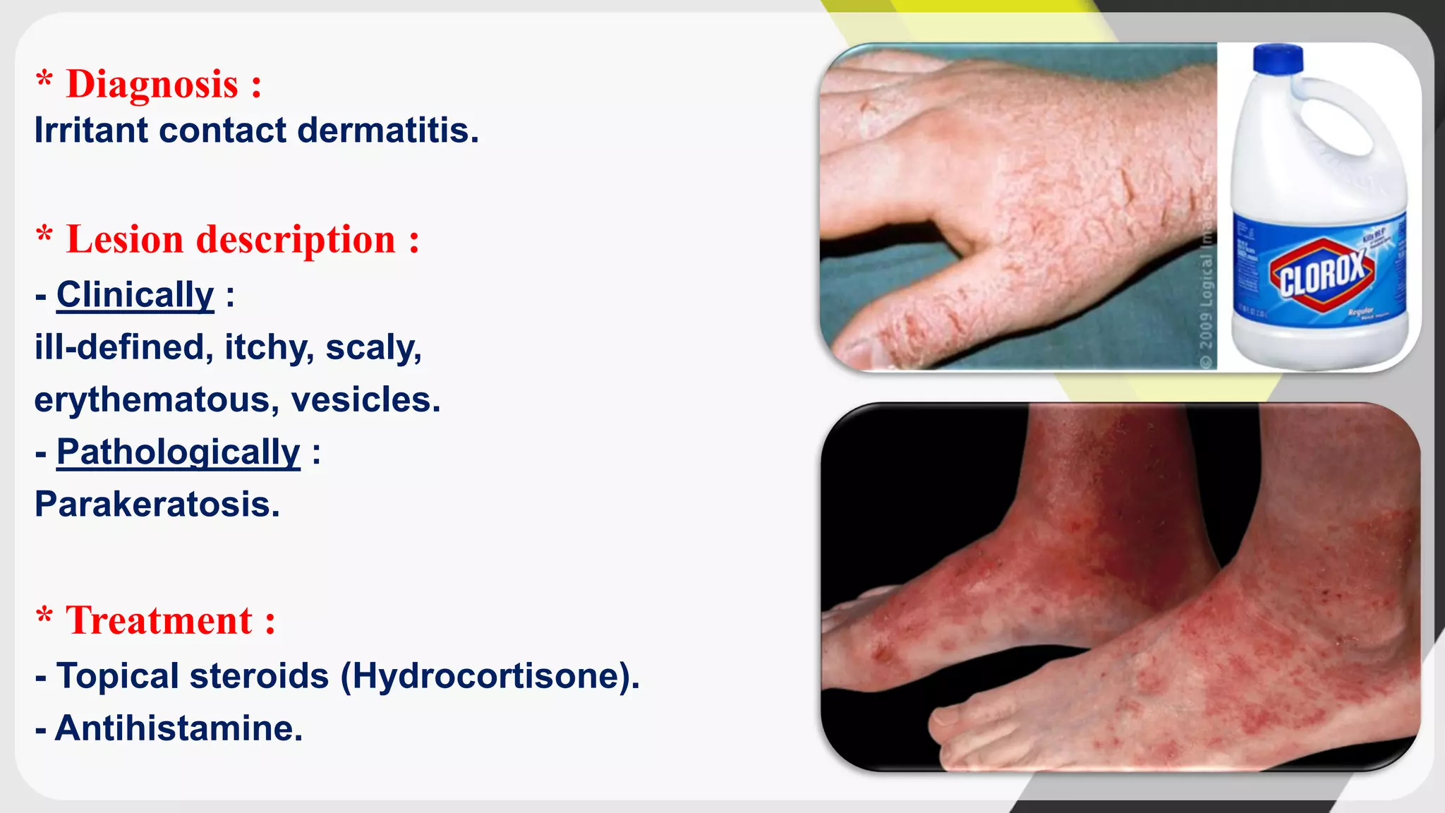 Dermatology (diagnosis of dermatological lesions) | PDF