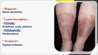Dermatology (diagnosis of dermatological lesions) | PDF