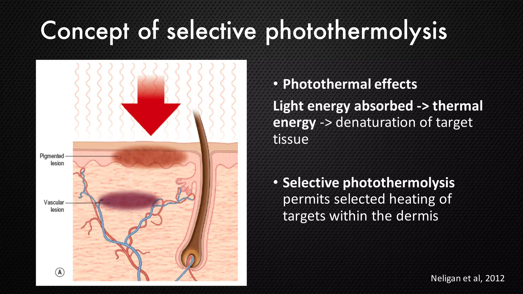Laser in Asian Skin | PDF