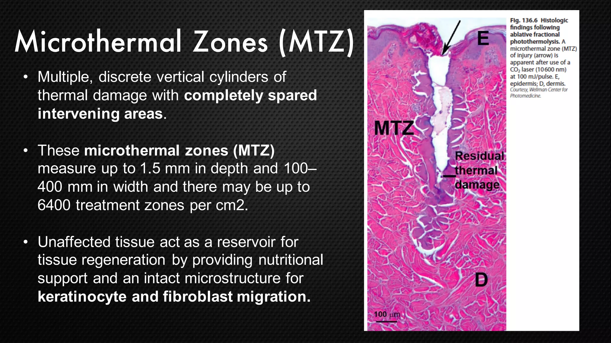 Laser in Asian Skin | PDF