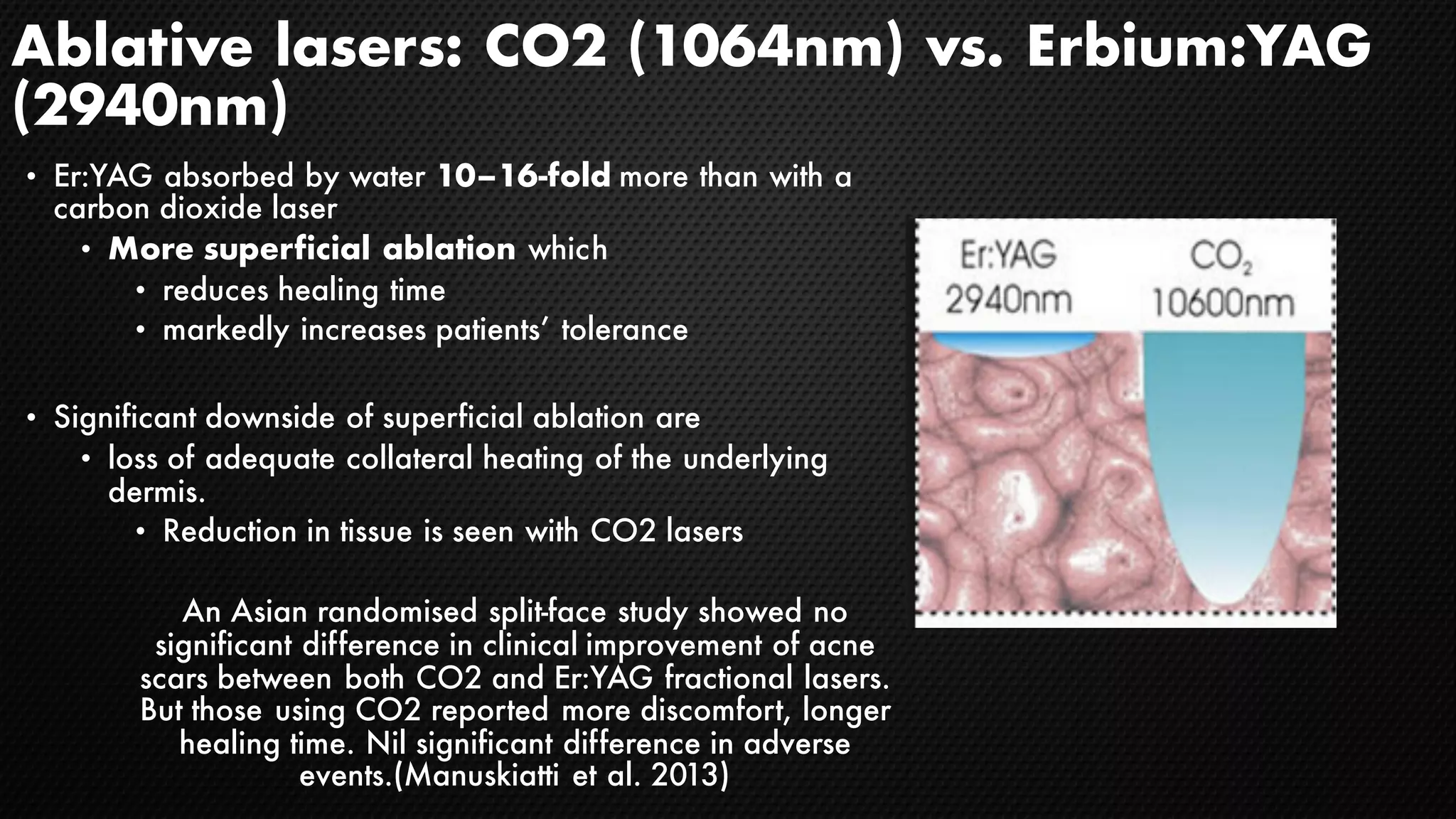 Laser in Asian Skin | PDF