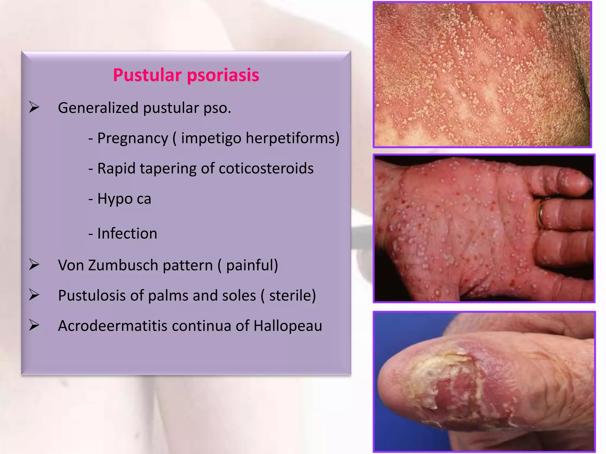 Dermatology Lecture Psoriasis ACNE AD | PPTX