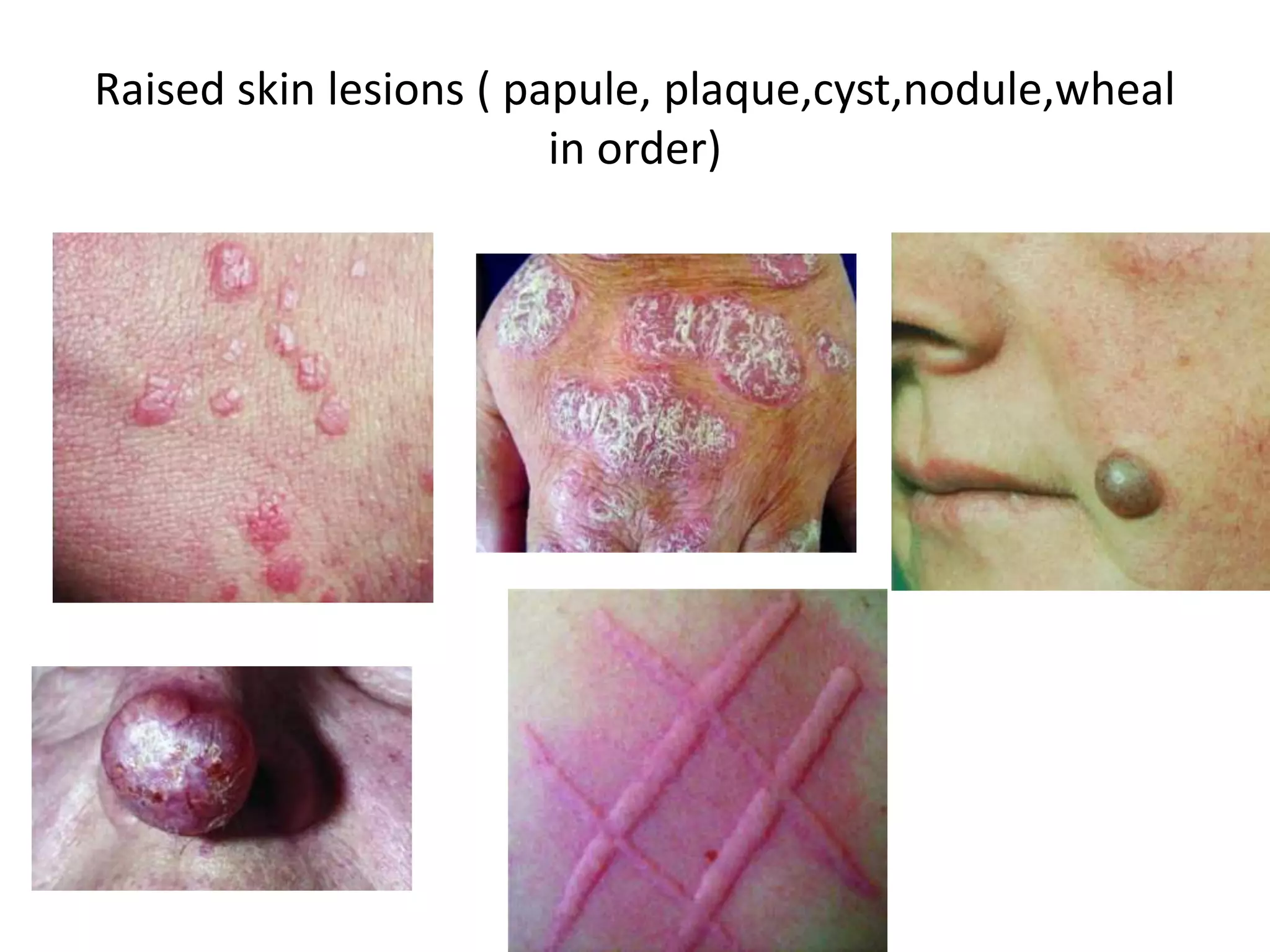 Dermatology lecture notes | PPTX