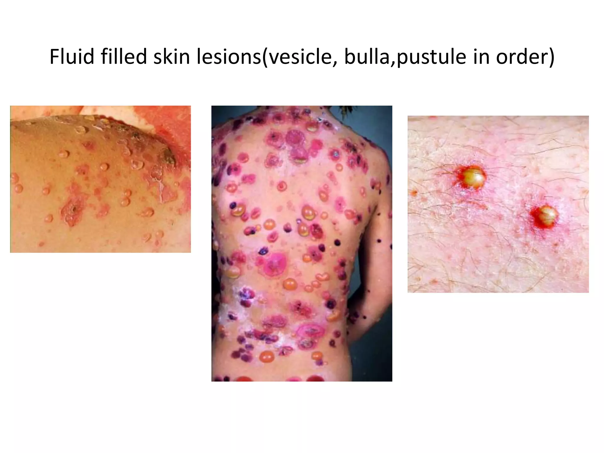 Dermatology lecture notes | PPTX