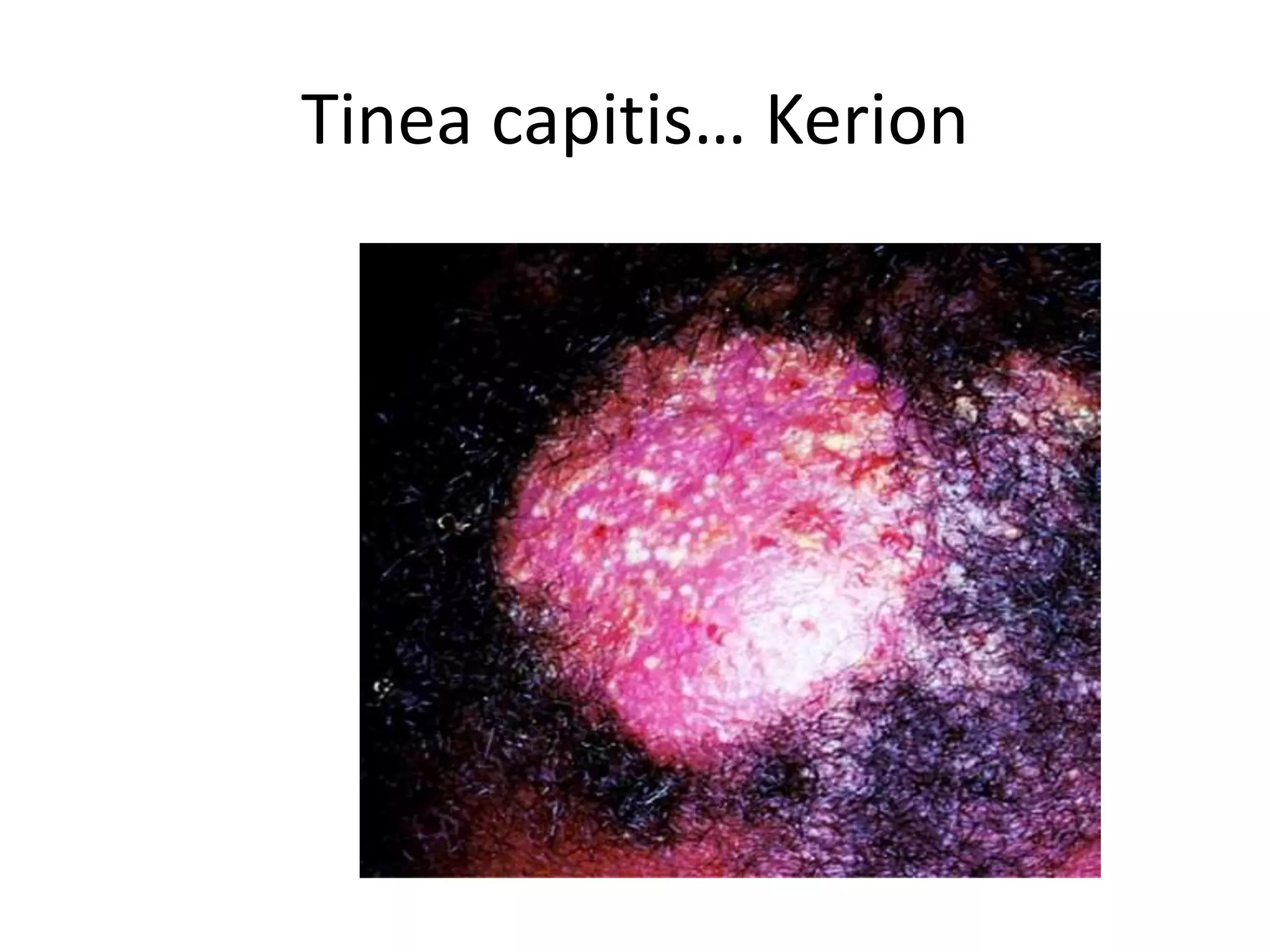 Dermatology lecture notes | PPTX