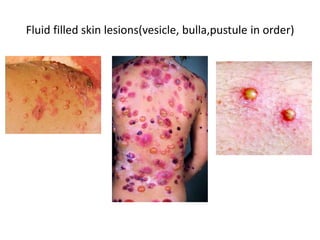 Dermatology lecture notes | PPTX