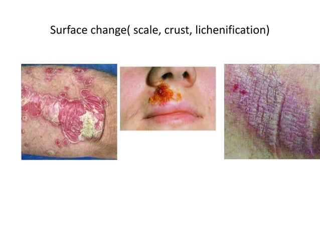 Dermatology lecture notes | PPTX | Skin and Dermatology | Diseases and ...