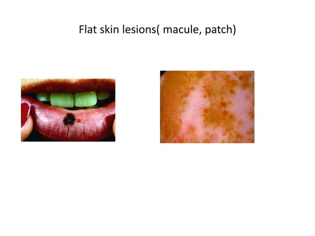 Dermatology lecture notes | PPTX | Skin and Dermatology | Diseases and ...