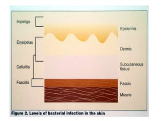 Dermatology lecture notes | PPTX