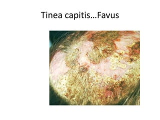 Dermatology lecture notes | PPTX