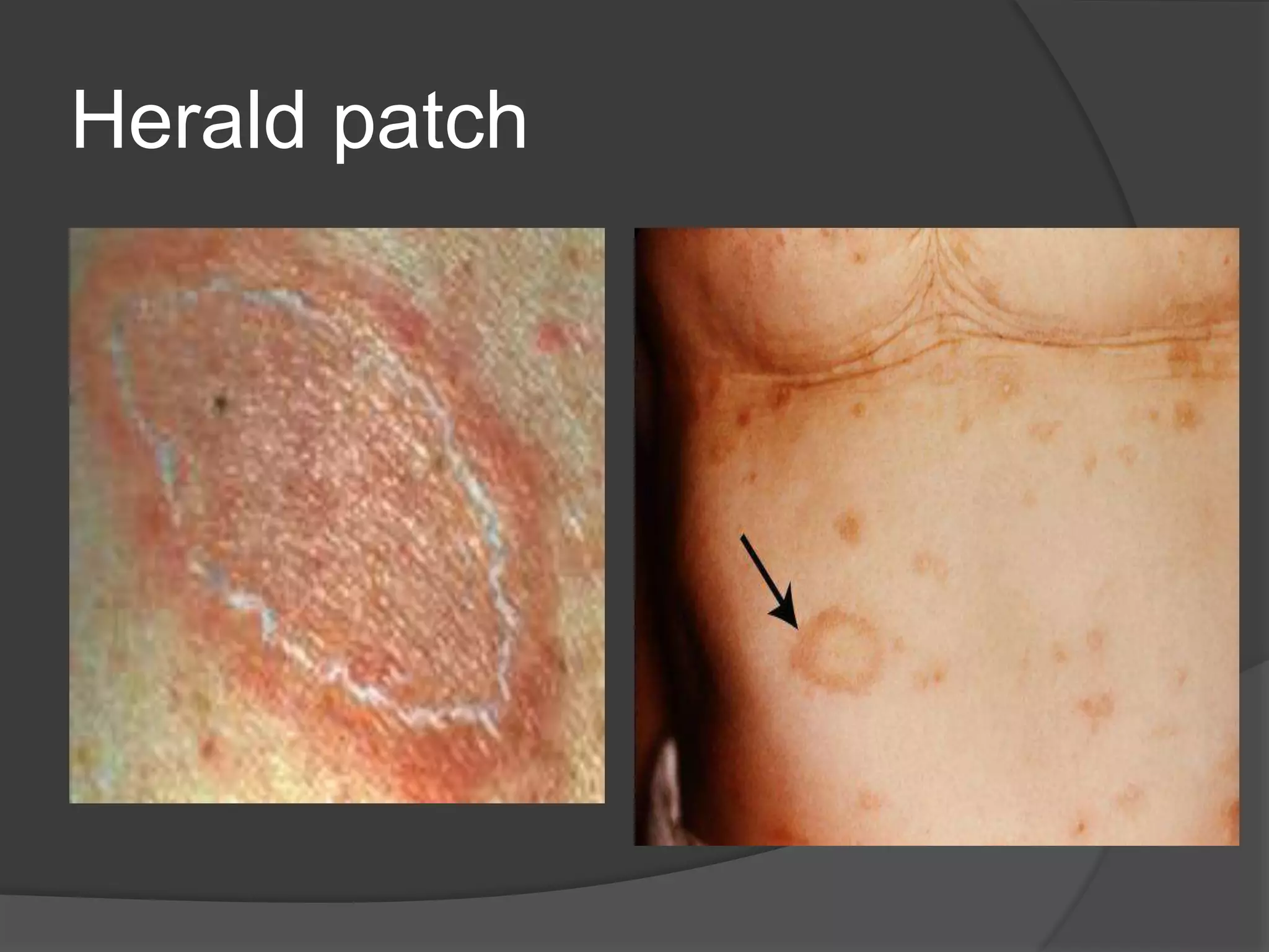 A total review of Dermatology by MS | PPTX