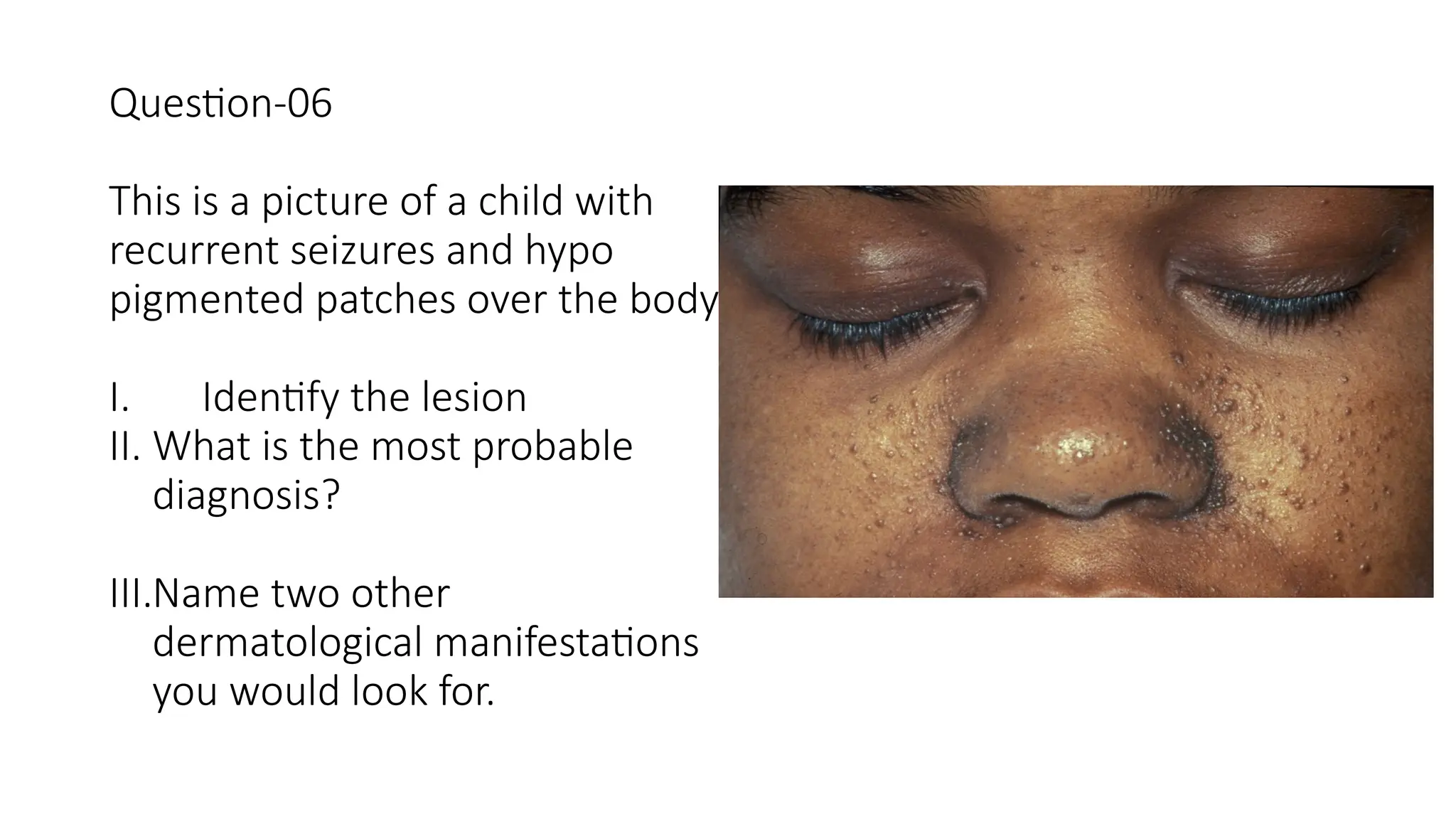 Dermatology picture quiz with answers for practice.pptx