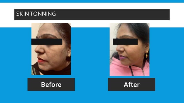 Dermatology Ppt 8 0 Pptx