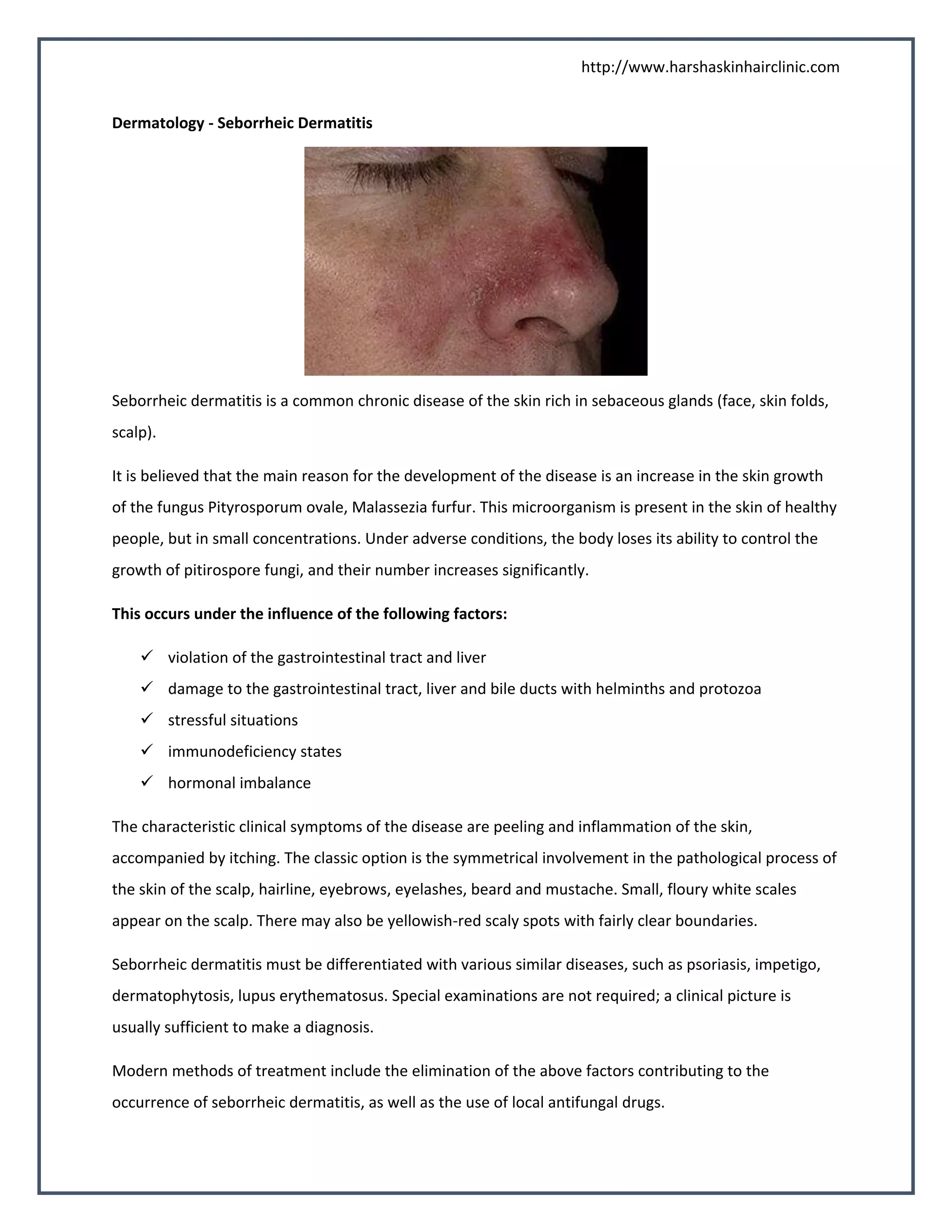 Dermatology - Seborrheic Dermatitis | PDF