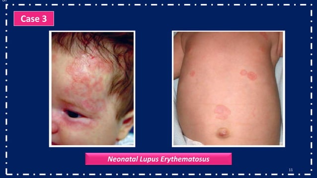 Pediatric Dermatology Spot Diagnosis | PPTX | Skin and Dermatology ...