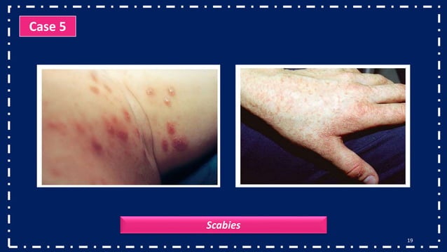 Pediatric Dermatology Spot Diagnosis | PPTX | Skin and Dermatology ...