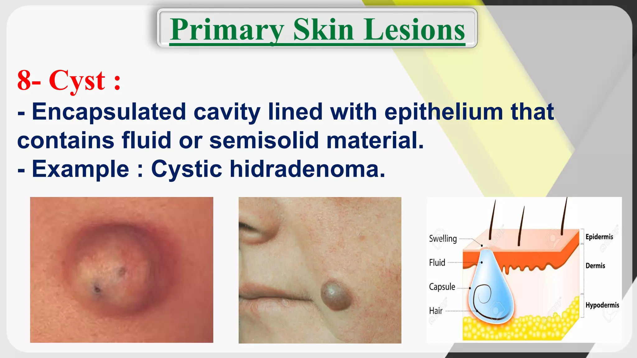 Dermatology (terminology of skin lesions) | PDF