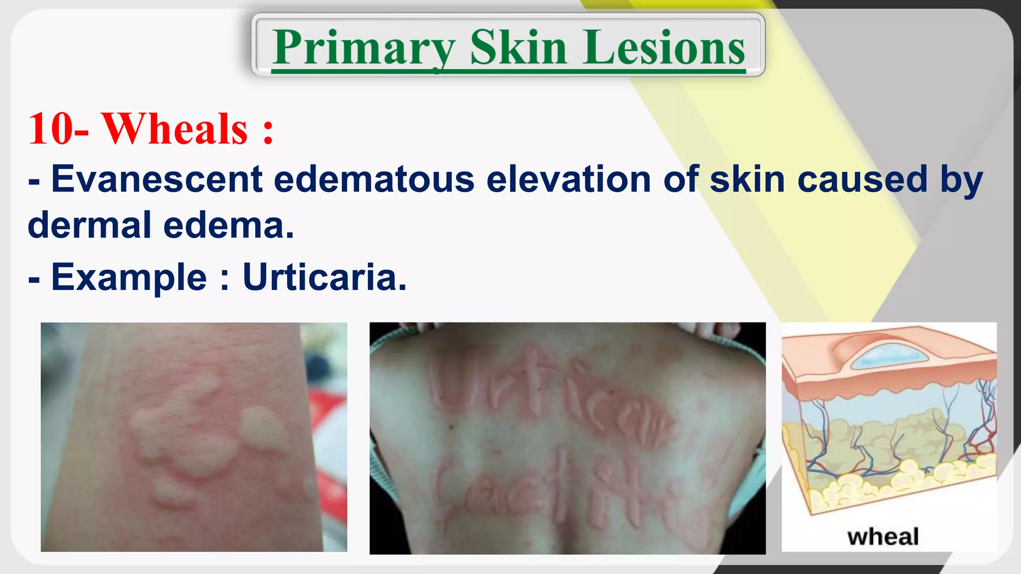 Dermatology (terminology of skin lesions) | PDF