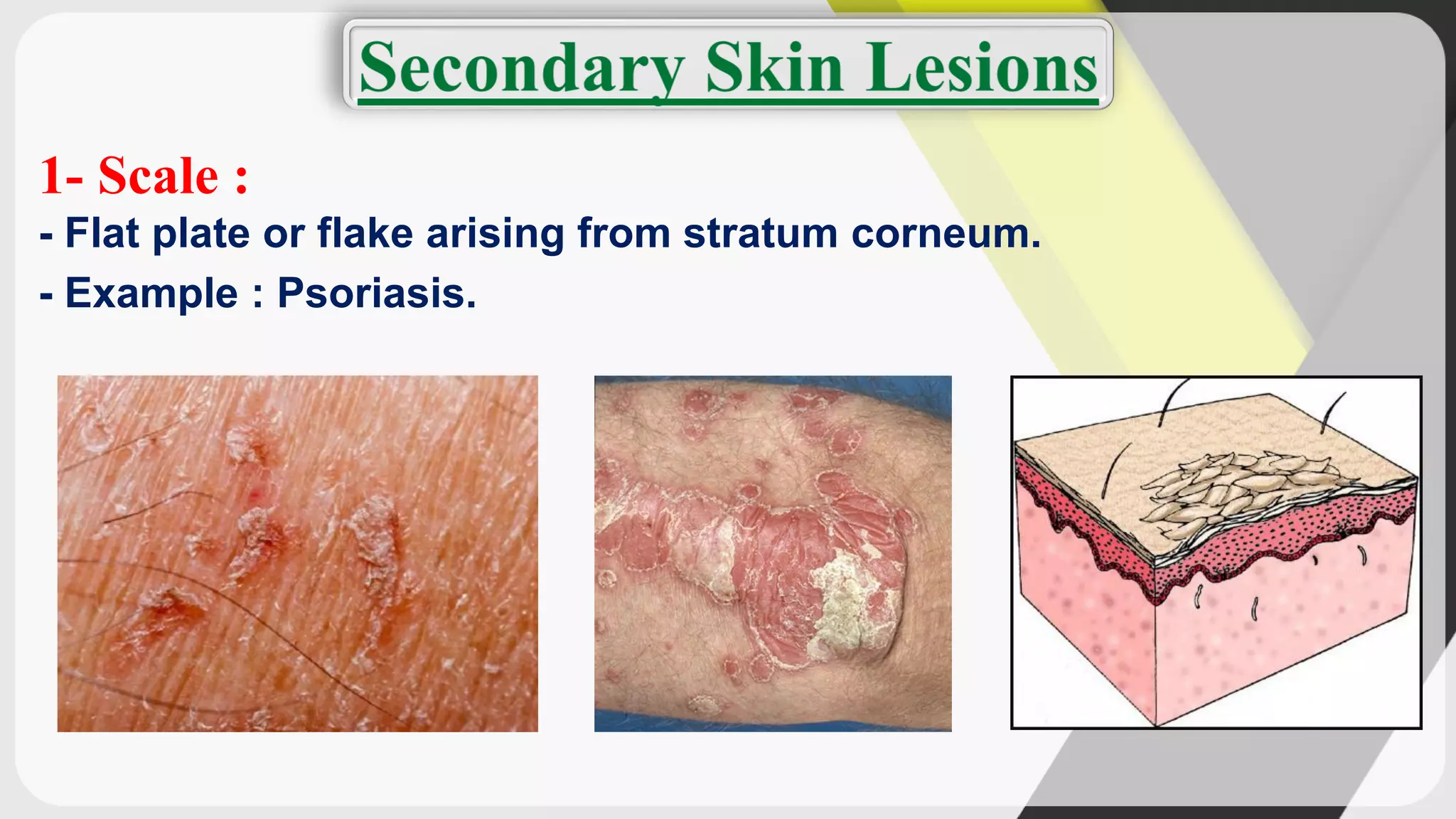 Dermatology (terminology of skin lesions) | PDF