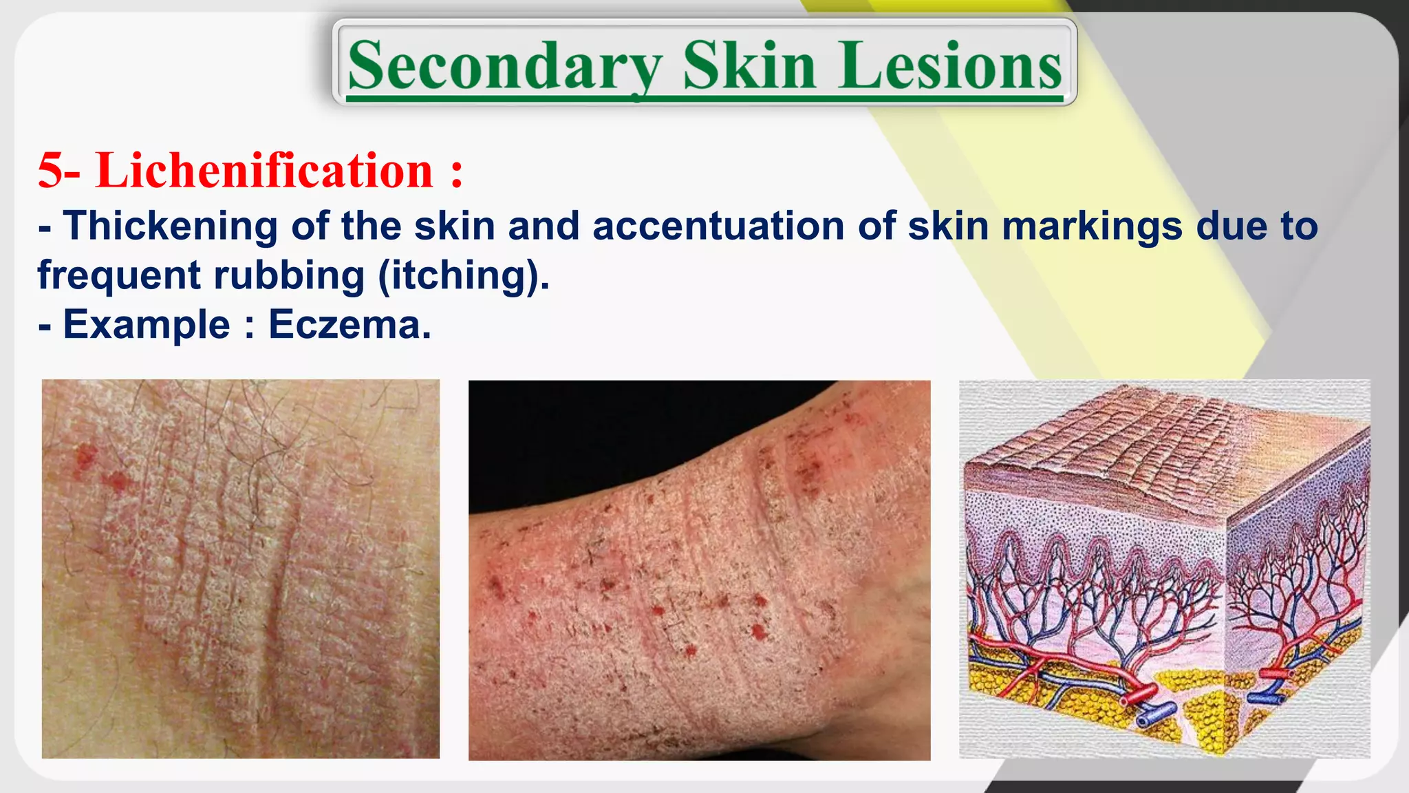 Dermatology (terminology of skin lesions) | PDF