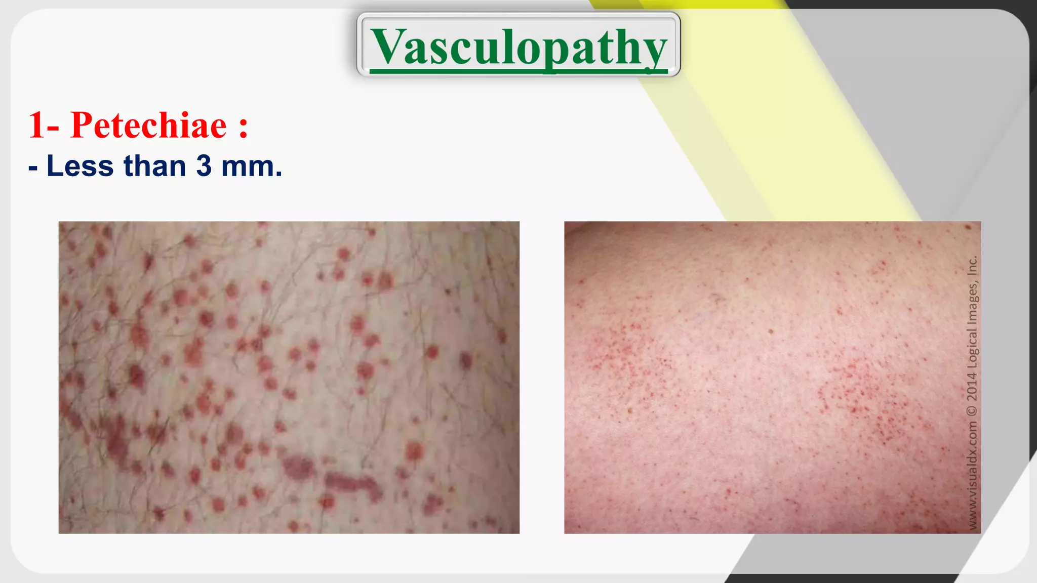 Dermatology (terminology of skin lesions) | PDF