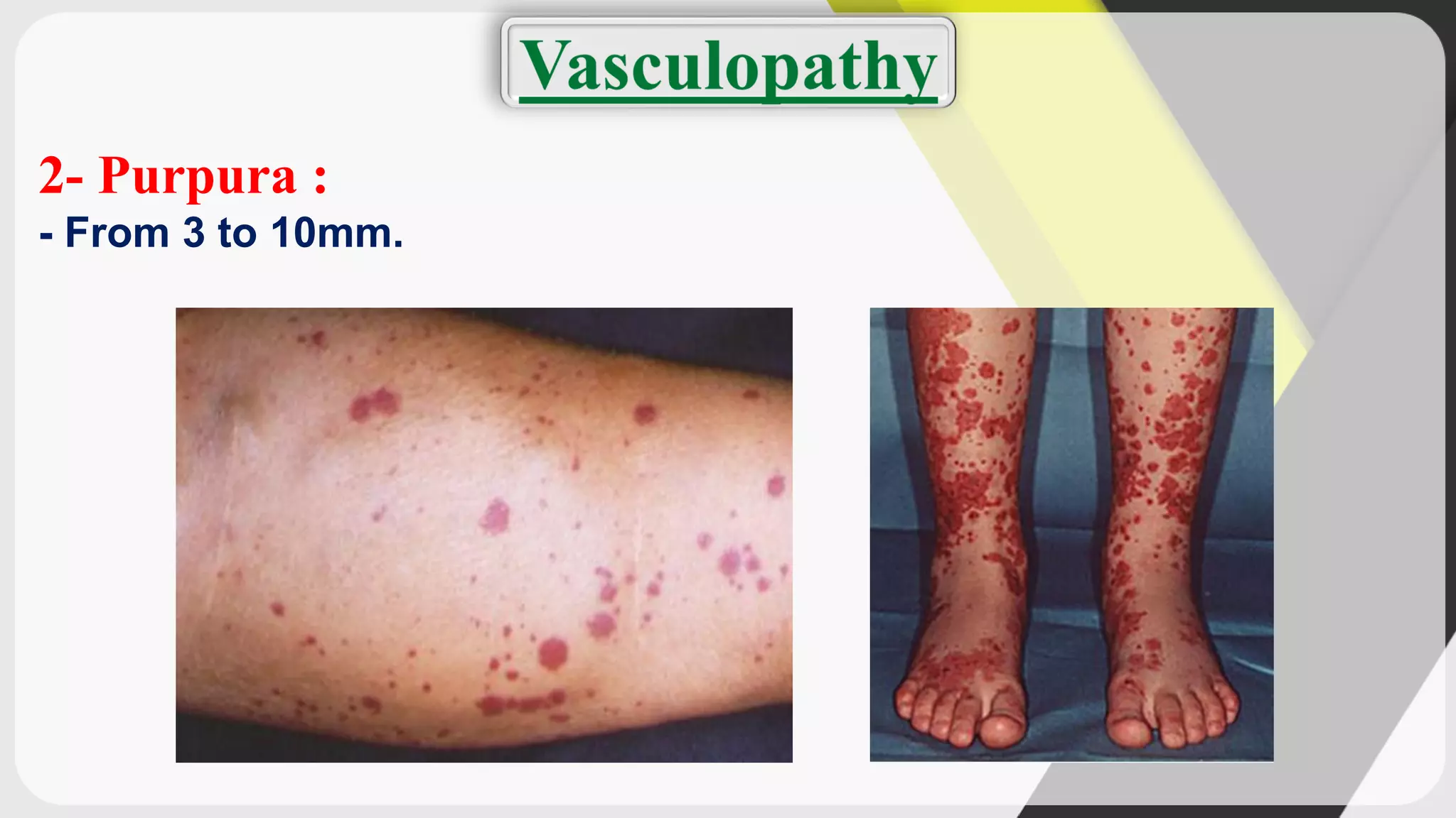 Dermatology (terminology of skin lesions) | PDF