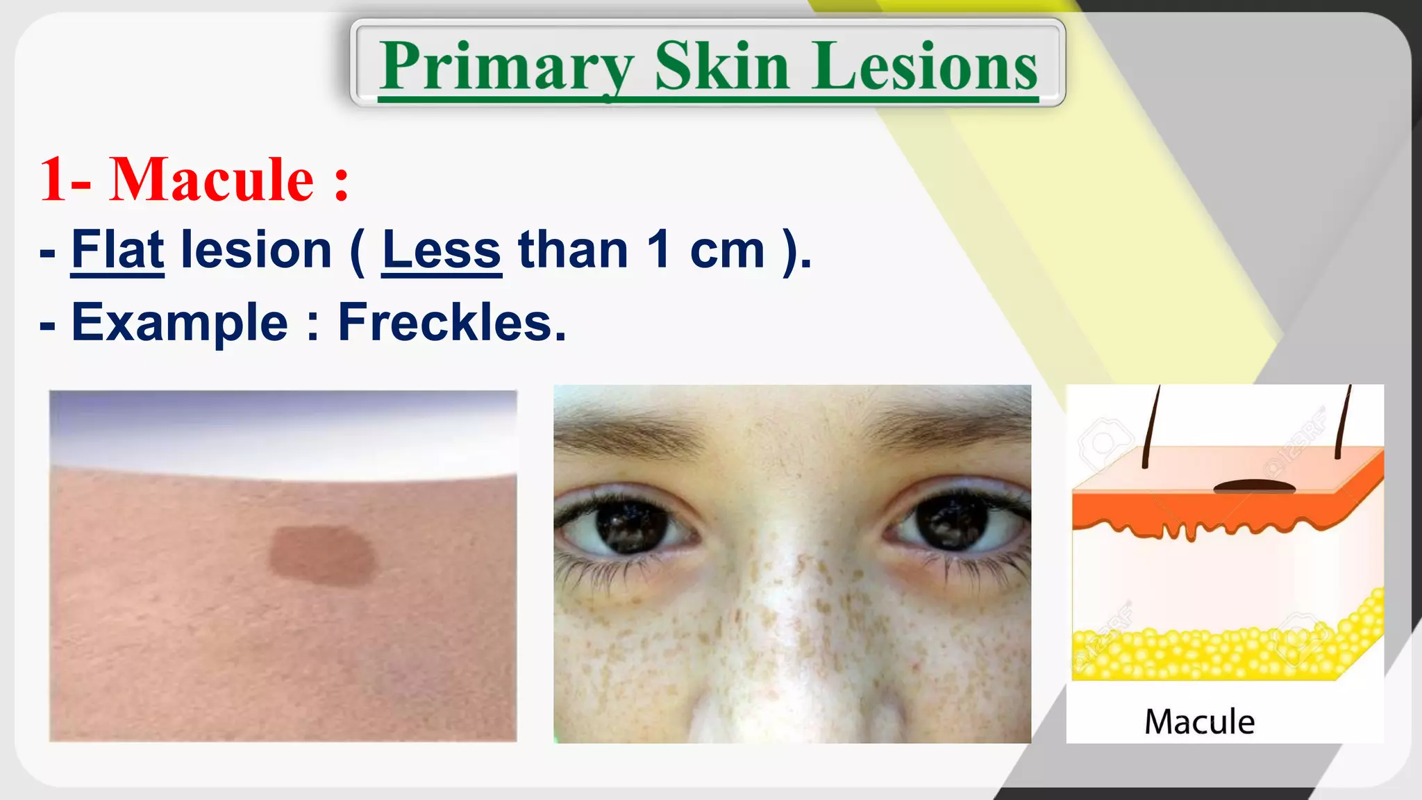 Dermatology (terminology of skin lesions) | PDF