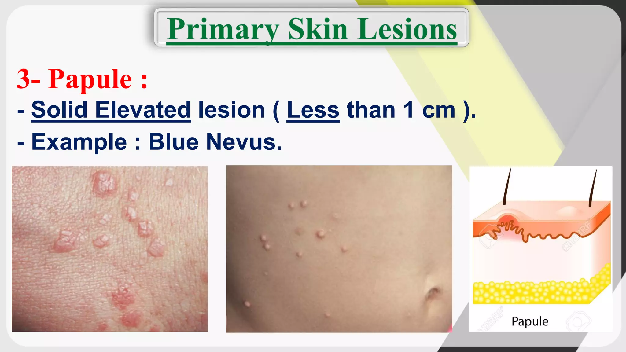 Dermatology (terminology of skin lesions) | PDF