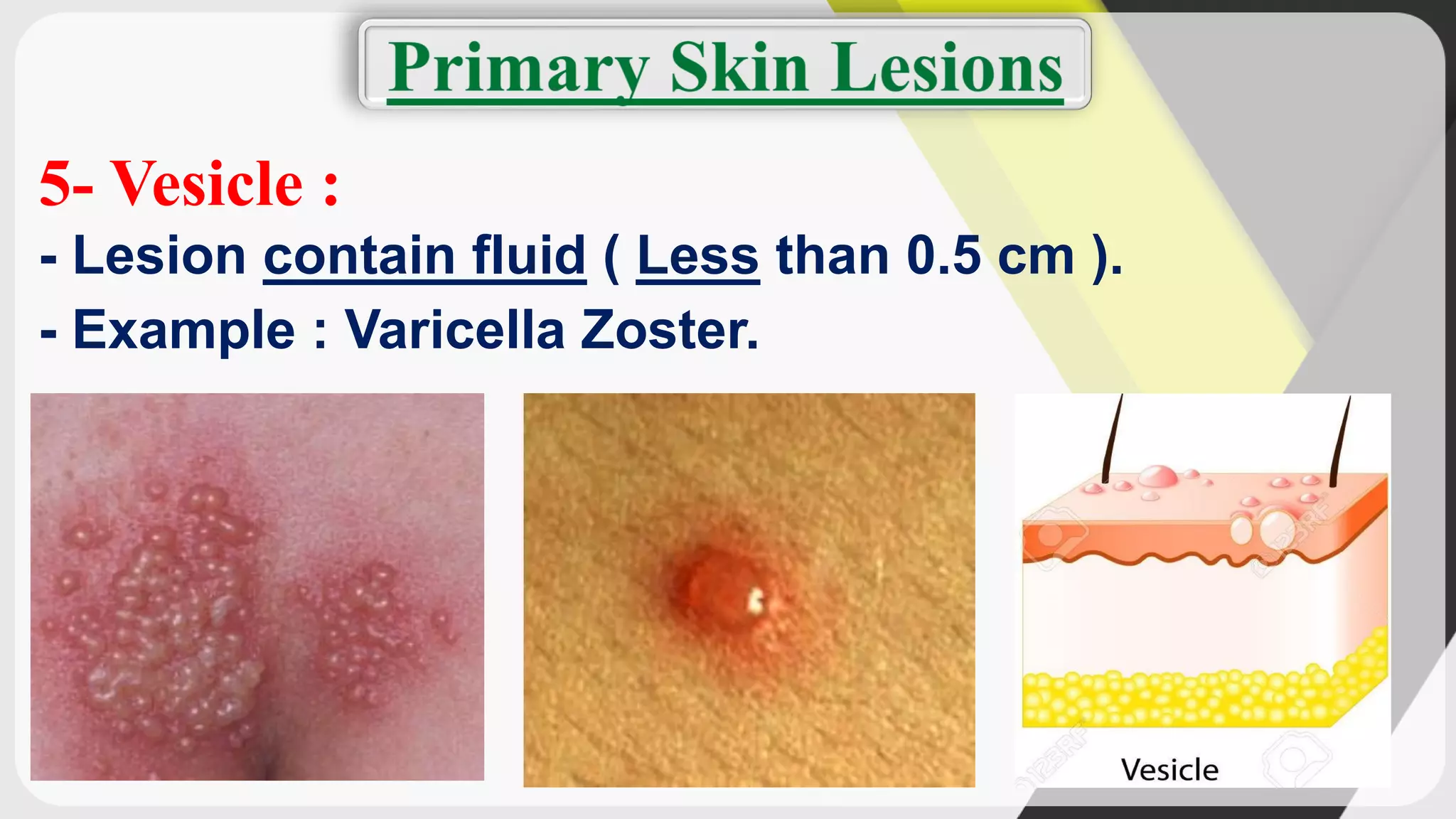 Dermatology (terminology of skin lesions) | PDF